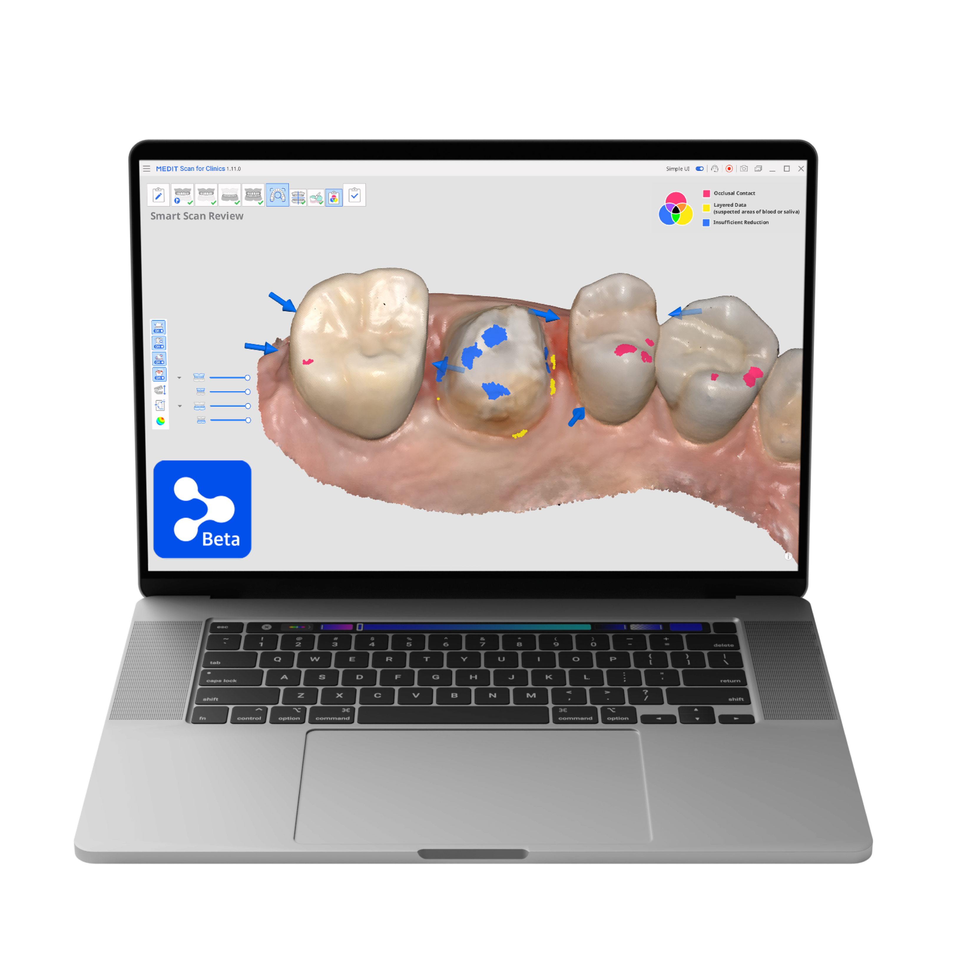 Try Medit Link Beta and Win a MacBook Pro 13!