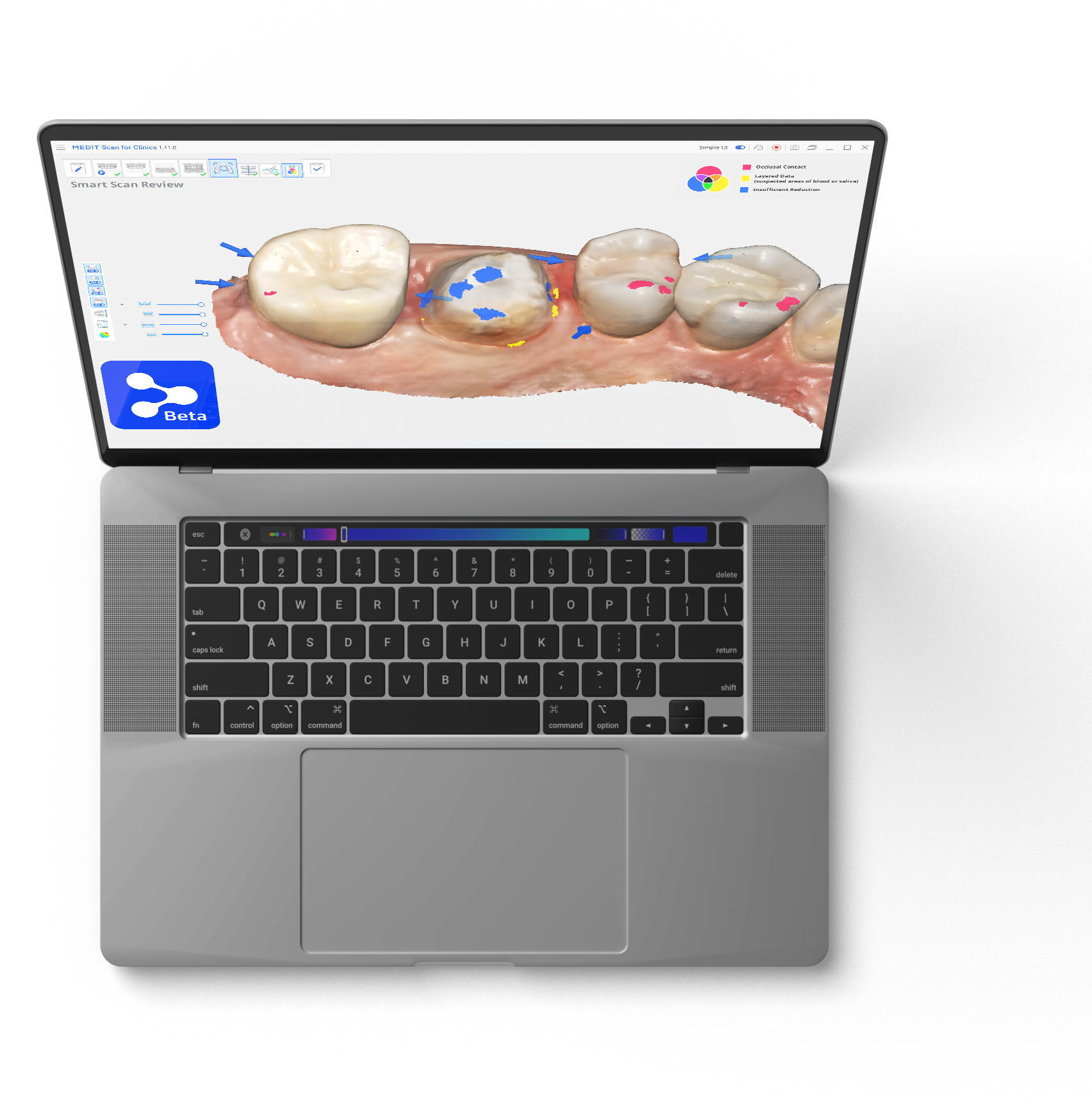 Try Medit Link Beta and Win a MacBook Pro 13!